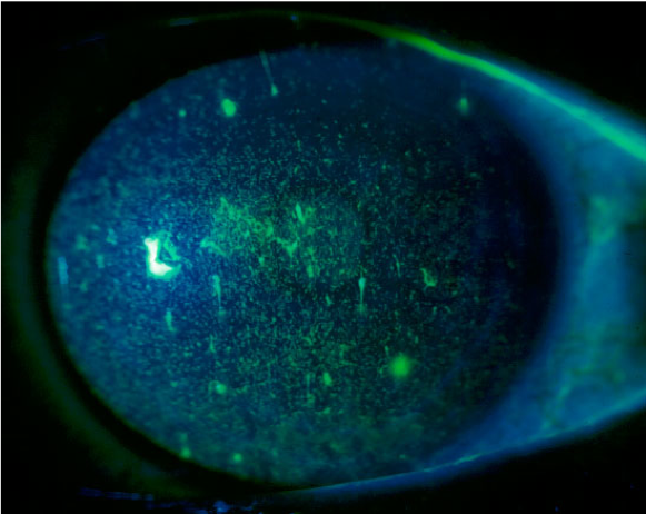 3b. Ocular Surface - Part 2
