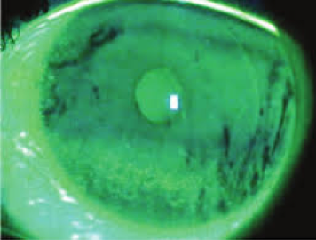 3b. Ocular Surface - Part 2