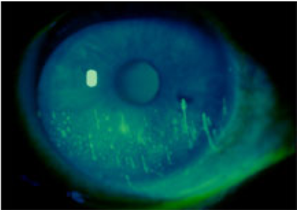 3b. Ocular Surface - Part 2